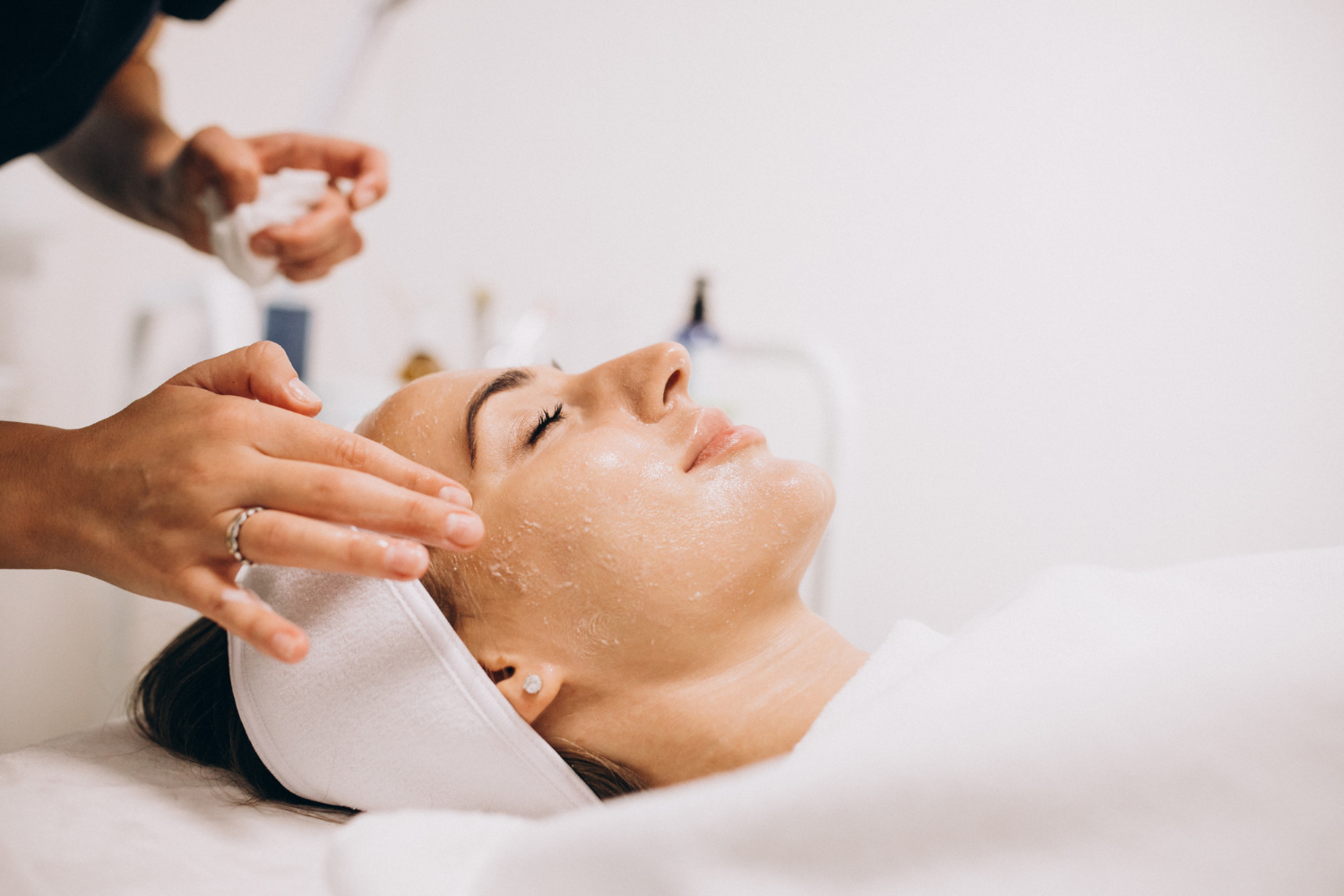PERIGO: entenda por que o peeling de fenol pode levar à morte